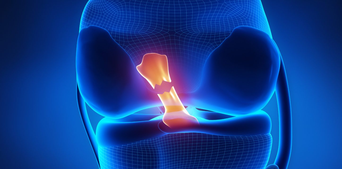 Australia’s most famous knee isn’t alone in its suffering | Health ...