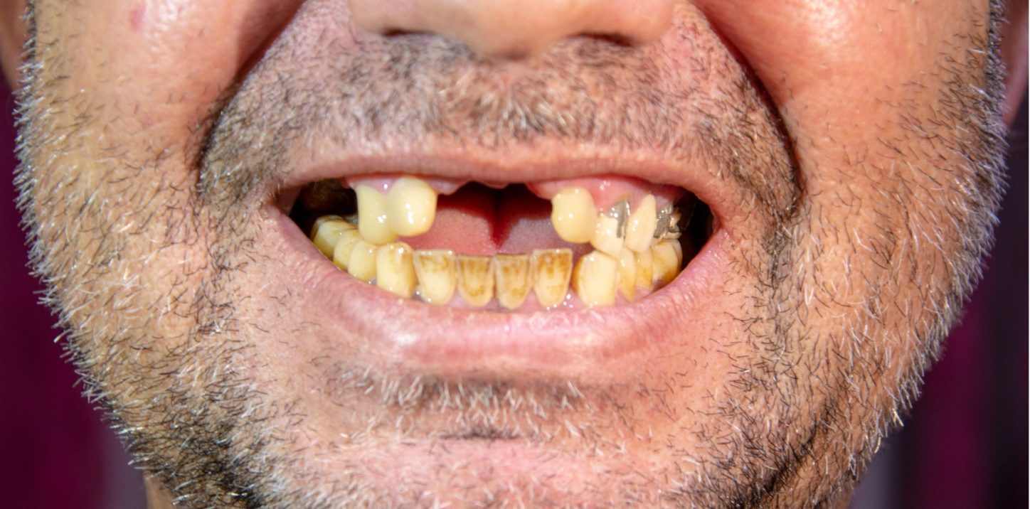 Significant gaps remain in Aussie dental care | Health Services Daily