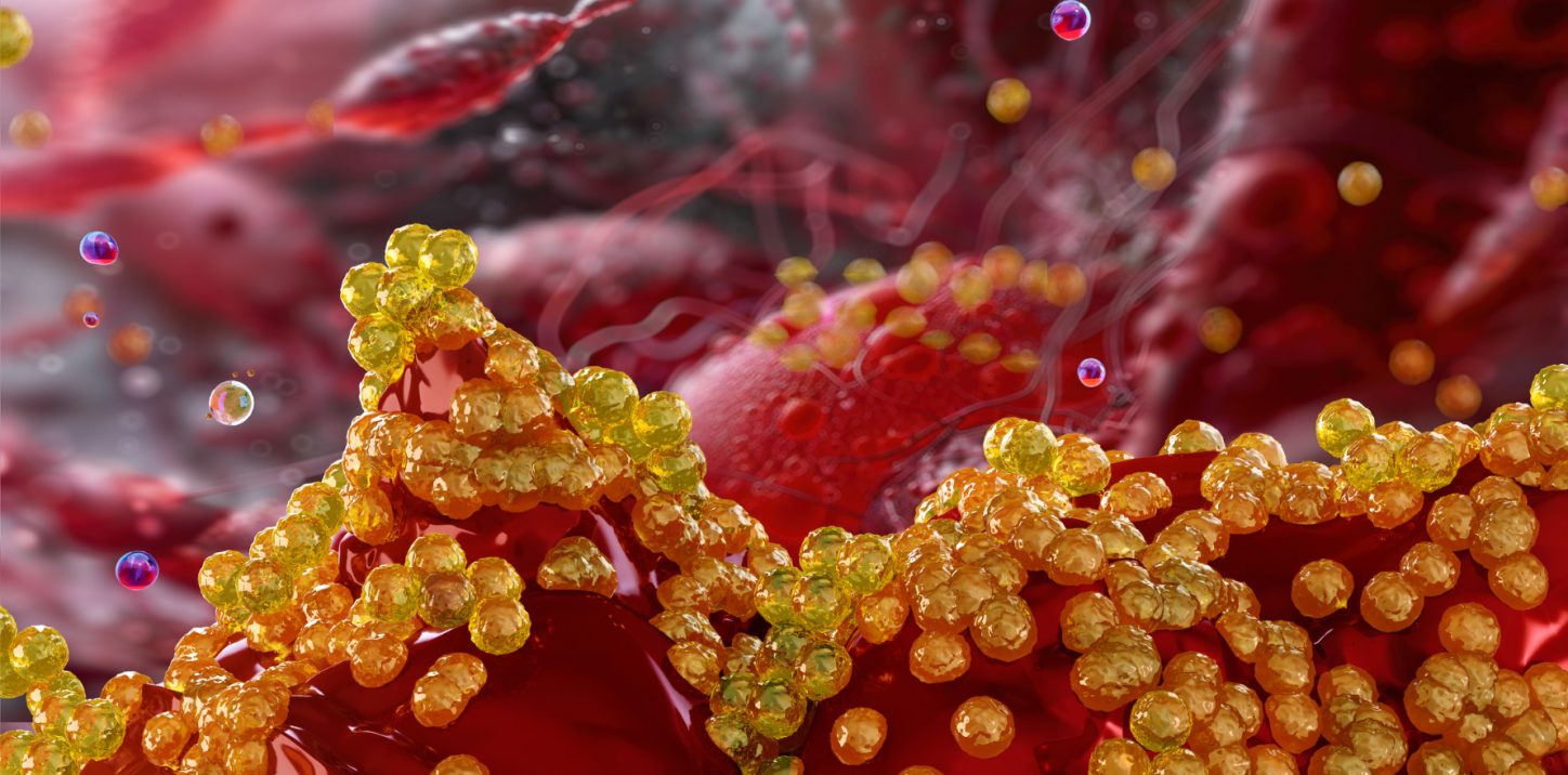 Hospital hotspots: where golden staph hit hardest | Health Services Daily